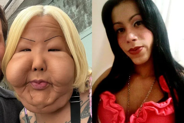 Veja como era Juju do Pix antes de aplicar óleo no rosto